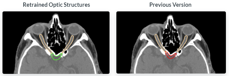Limbus Contour v1.8 Highlights