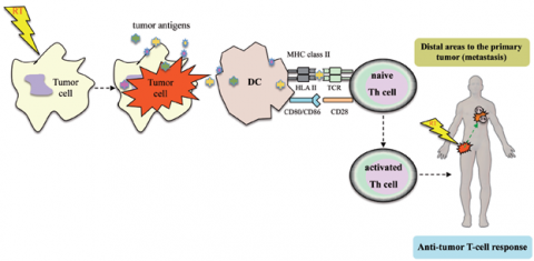 The Abscopal Effect | Radformation