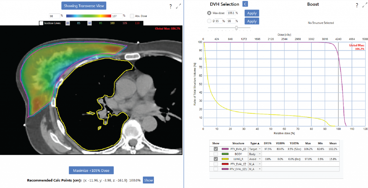 Halcyon Planning Advanced with EZFluence | Radformation