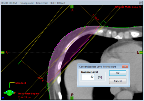 Tips & Tricks: Eclipse Contouring | Radformation