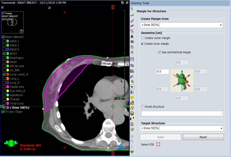 Tips & Tricks: Eclipse Contouring | Radformation