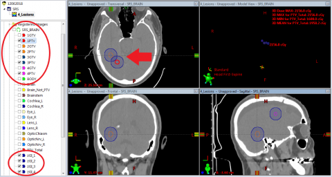 Tips & Tricks: Eclipse Contouring | Radformation