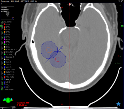 Tips & Tricks: Eclipse Contouring | Radformation